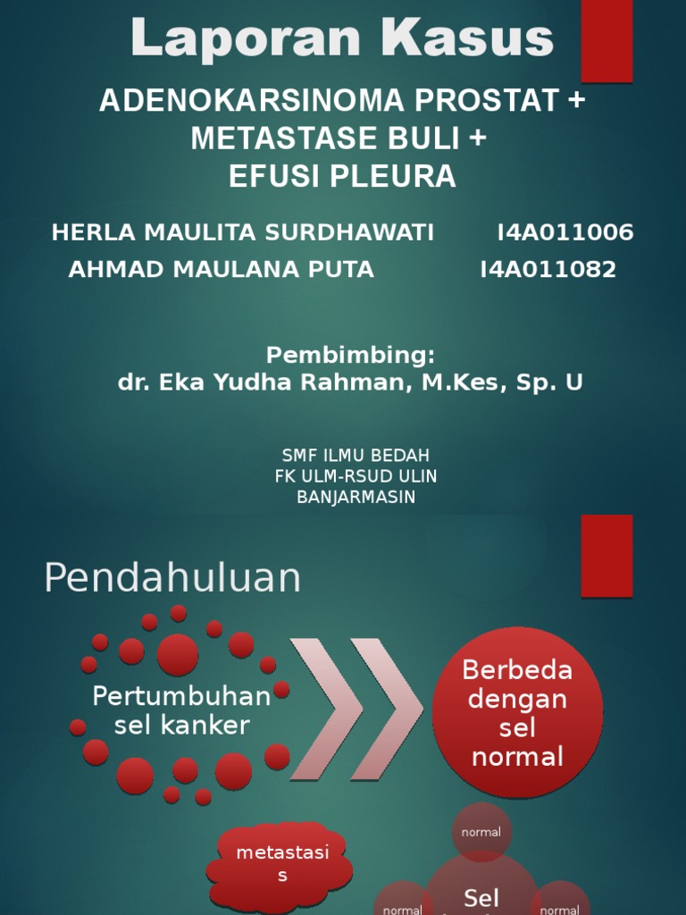 Laporan Kasus Ca Prostat | PDF