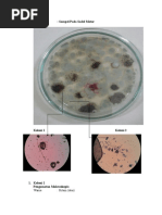 Perbedaan Kapang Dan Khamir (Mould and Yeast) | PDF