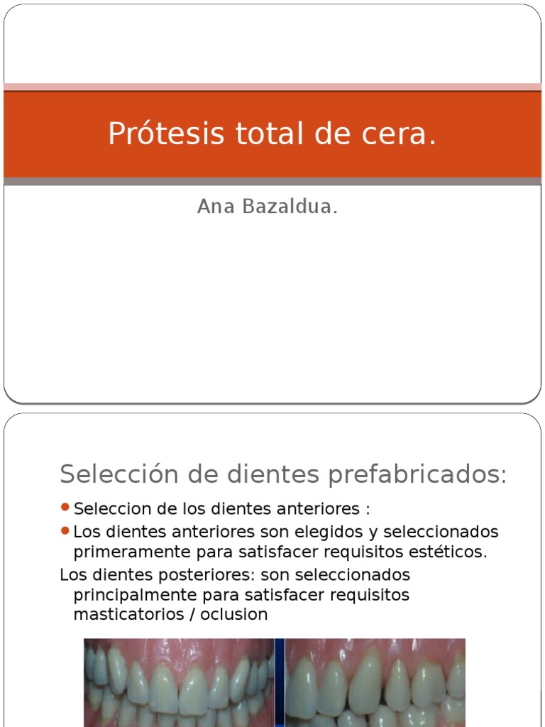Prótesis Total de Cera | PDF | Dentadura postiza | Diente humano