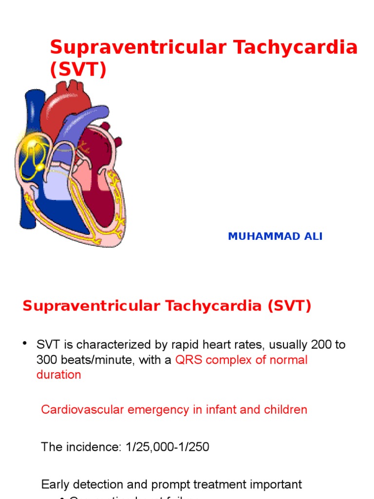 K7 - Supraventricular Tachycardia (SVT) | PDF | Heart Failure | Atrium ...