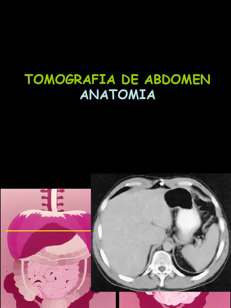 TC Anatomia Abdomen | PDF