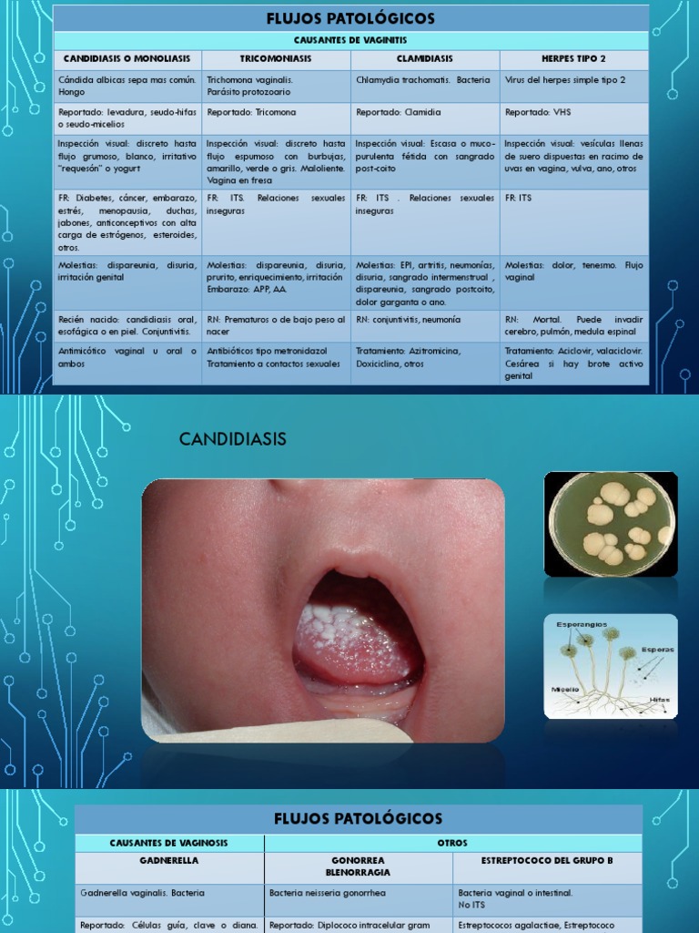 Flujos patológicos | Candidiasis | El embarazo