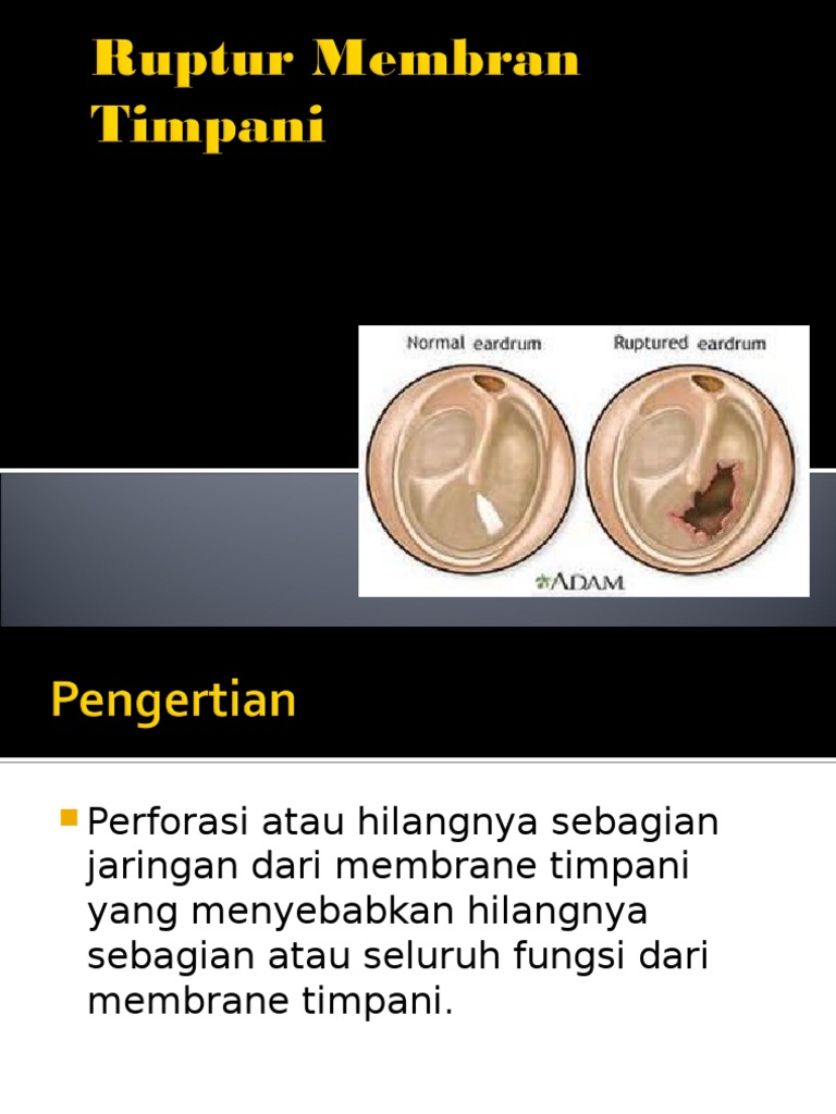 Perforasi Membran Timpani: Tipe dan Penanganan | PDF