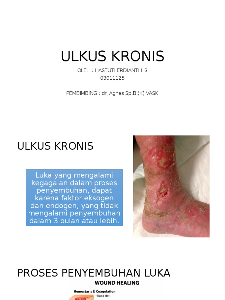 Jenis dan Penanganan Ulkus Kronis | PDF | Kesehatan Holistik