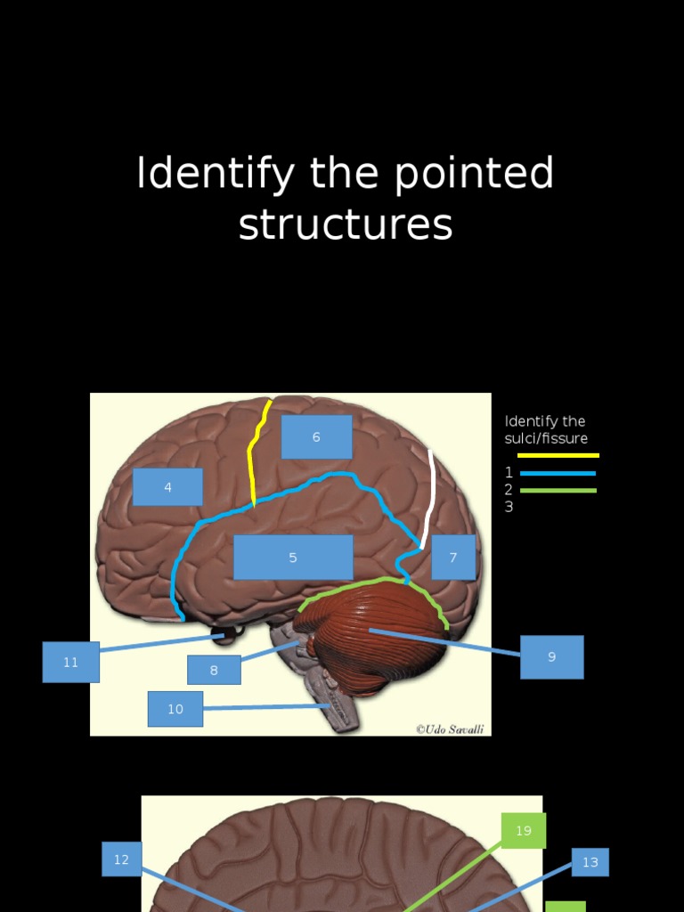 Physiology-Anatomy of The Brain | PDF