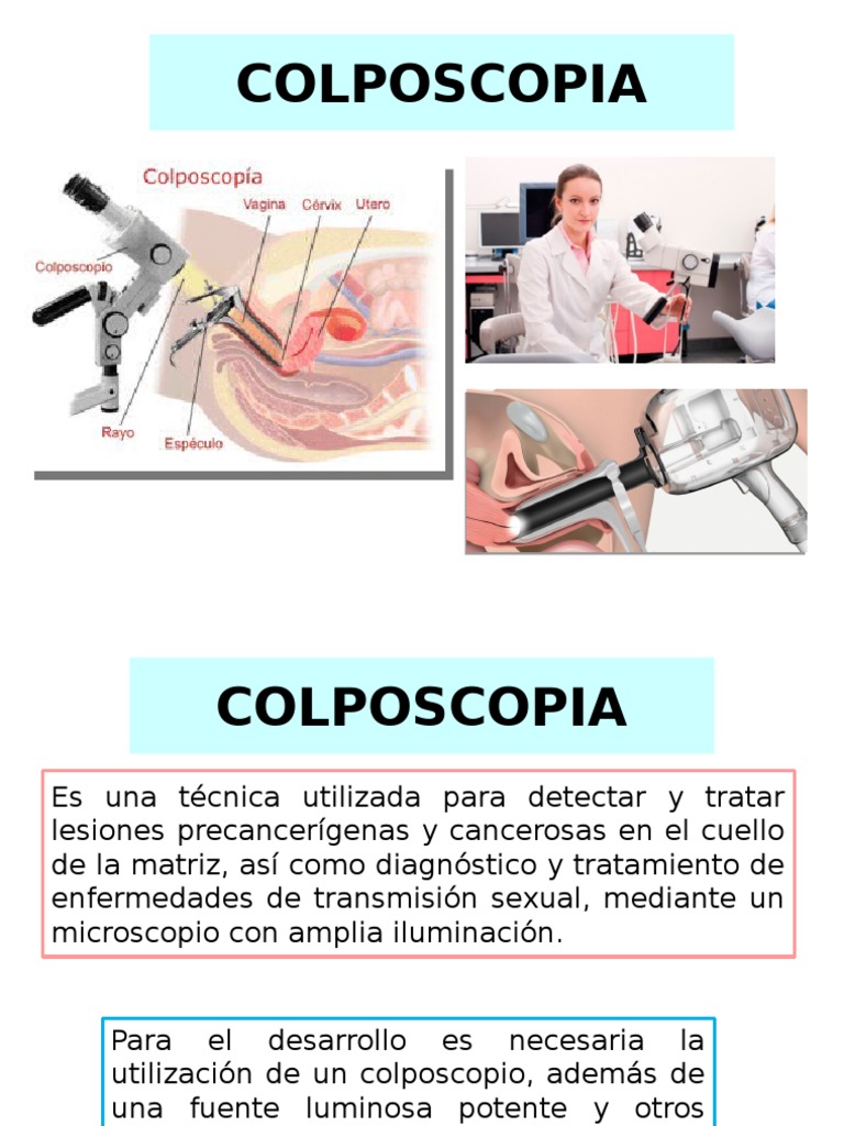 Colposcopia: Diagnóstico y Resultados | PDF