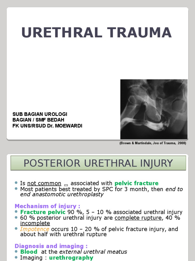 Urethral Injury: Types and Management | PDF | Catheter | Urology