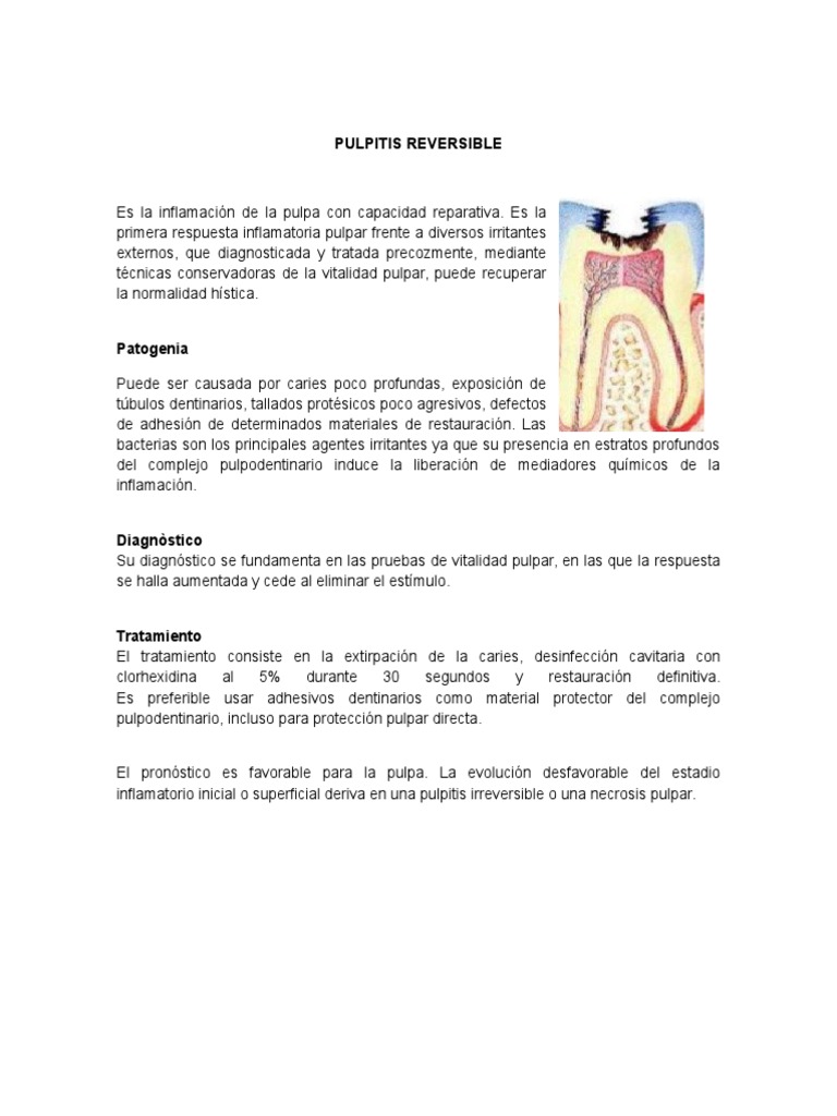Pulpitis Reversible | PDF | Inmunología | Ciencias de la Salud