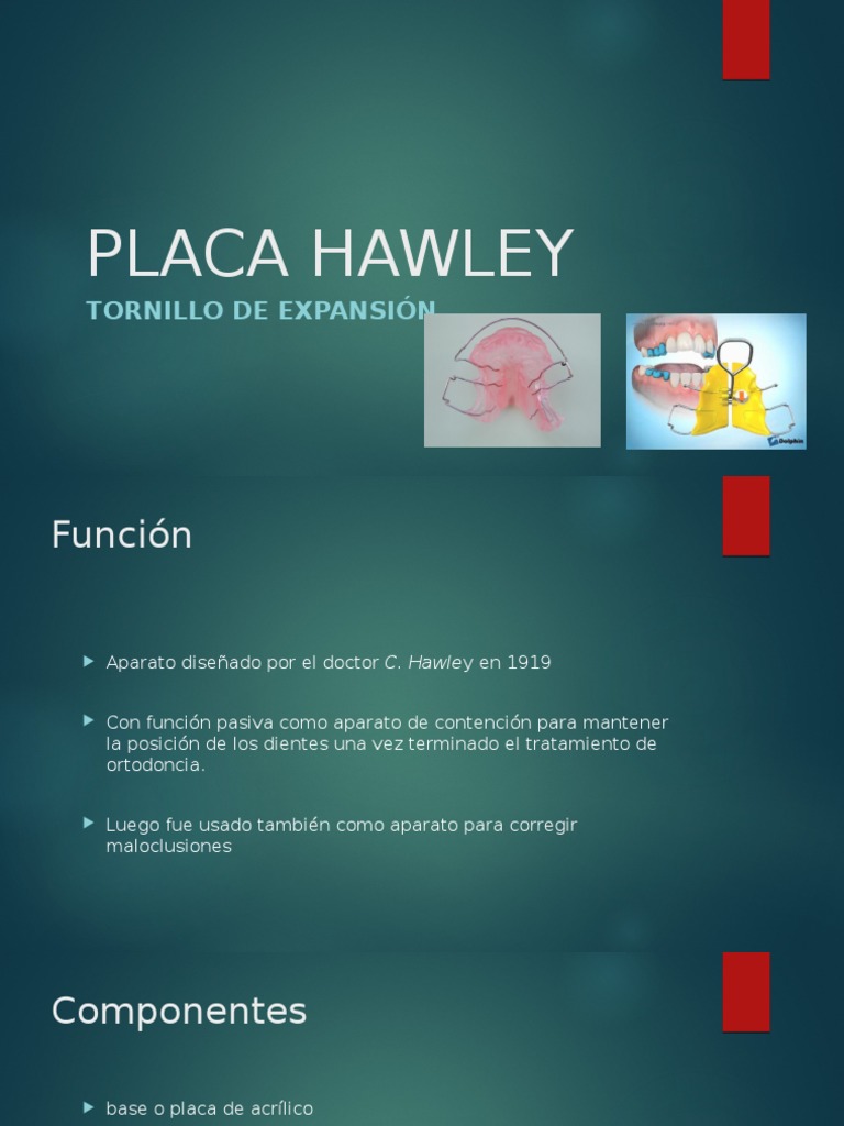 Placa Hawley | PDF