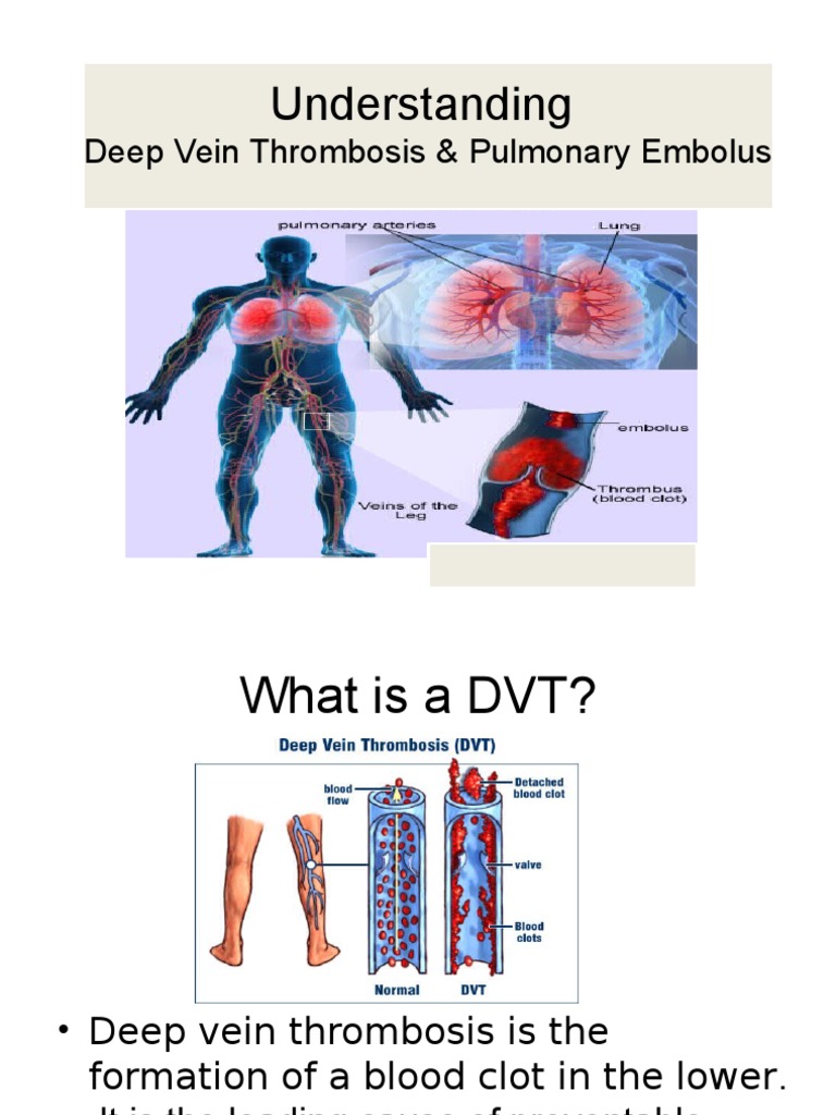 DVT & Pulmonary Embolus | PDF | Vein | Thrombosis