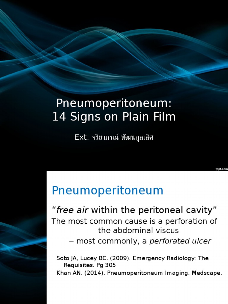 Signs of Pneumoperitoneum on Film | PDF | Abdomen | Stomach