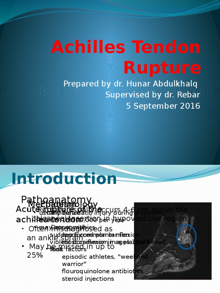 Achilles Tendon Rupture | PDF | Clinical Medicine | Human Anatomy