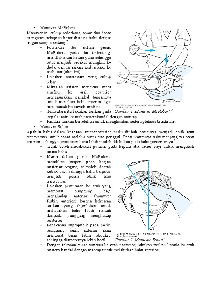 Manuver McRobert | PDF
