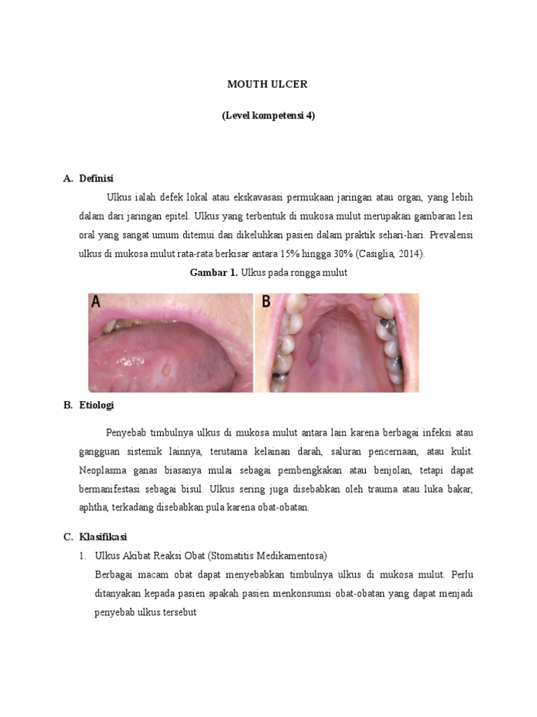 Jenis dan Penanganan Ulkus Mulut | PDF | Pengembangan Diri | Kesehatan ...