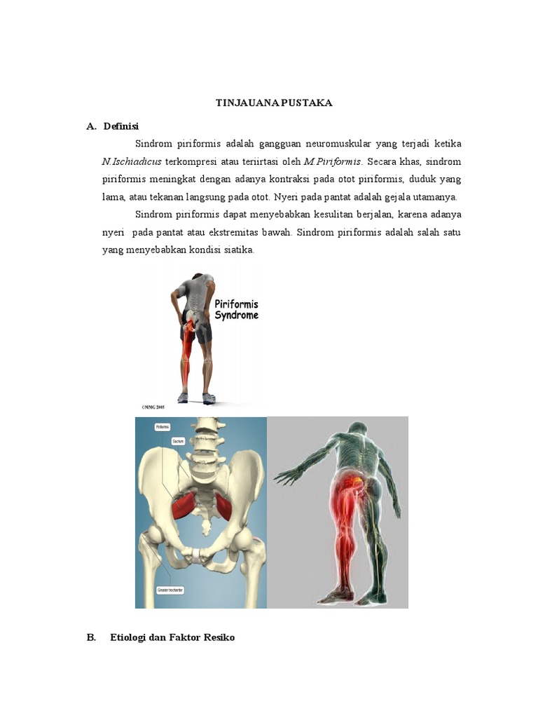 Sindrom Piriformis: Gejala dan Penanganan | PDF | Sains & Matematika