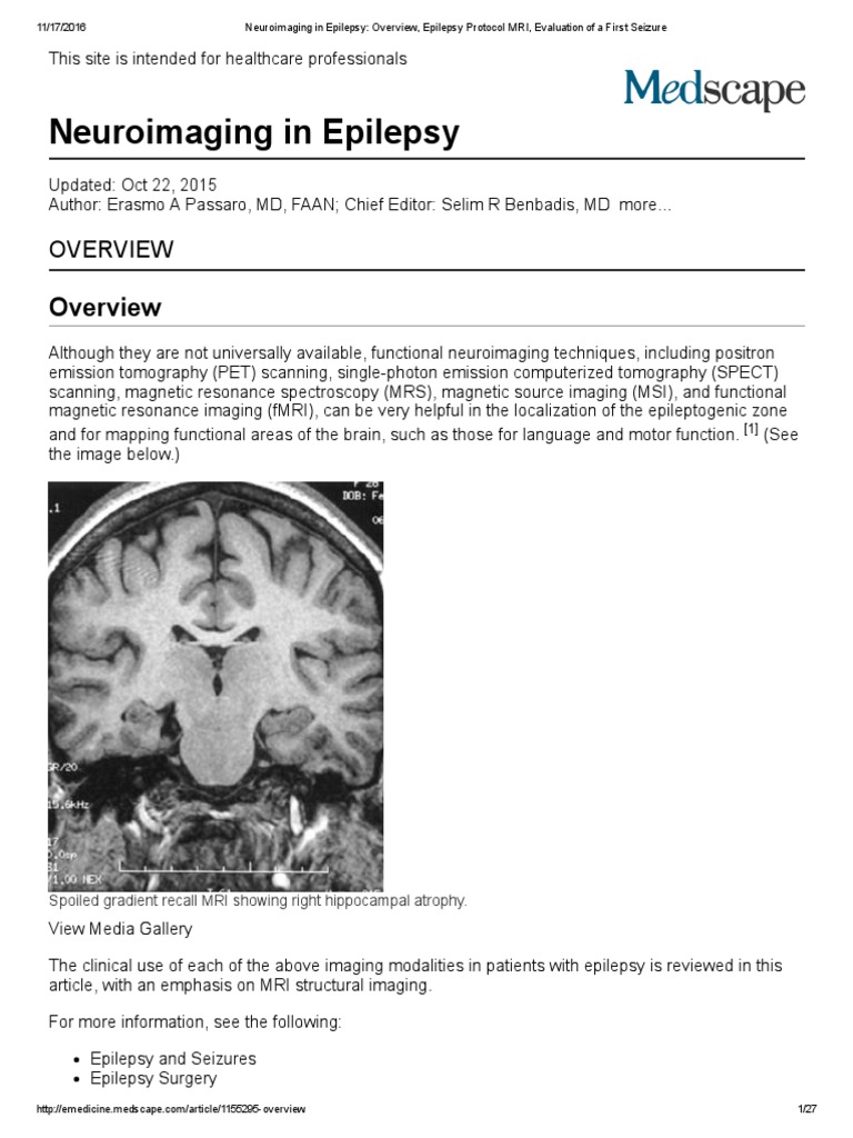 Neuroimaging in Epilepsy - Overview, Epilepsy Protocol MRI, Evaluation ...