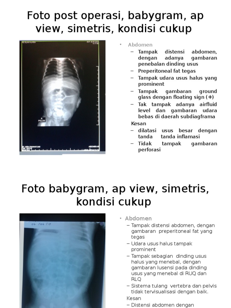 Expertise Foto Babygram, AP View, Simetris | PDF