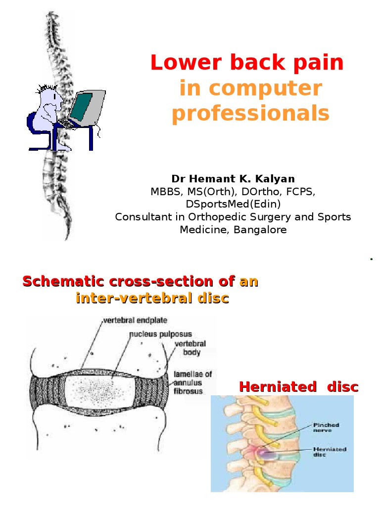 Back Pain Management for Computer Pros | PDF