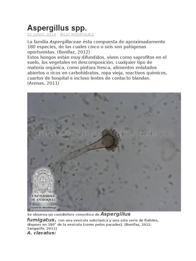 Aspergillus SPP | Aspergilo | Hongo