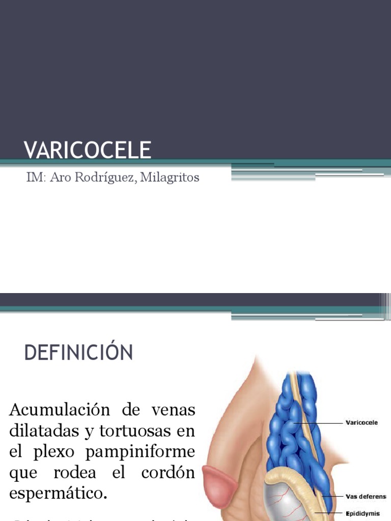 Clasificación y manejo del varicocele | PDF | Anatomía | Especialidades ...