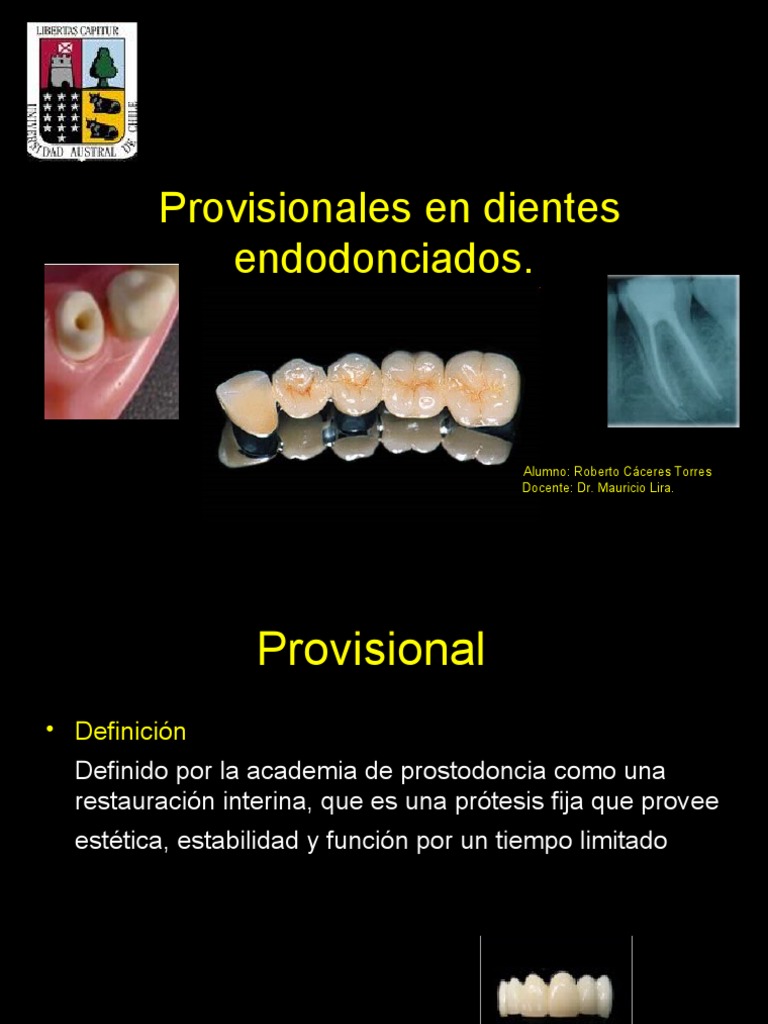 Provisionales en Dientes | PDF | Dentadura postiza | Boca