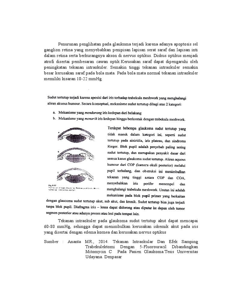 Penurunan Penglihatan Pada Glaukoma Terjadi Karena Adanya Apoptosis Sel ...