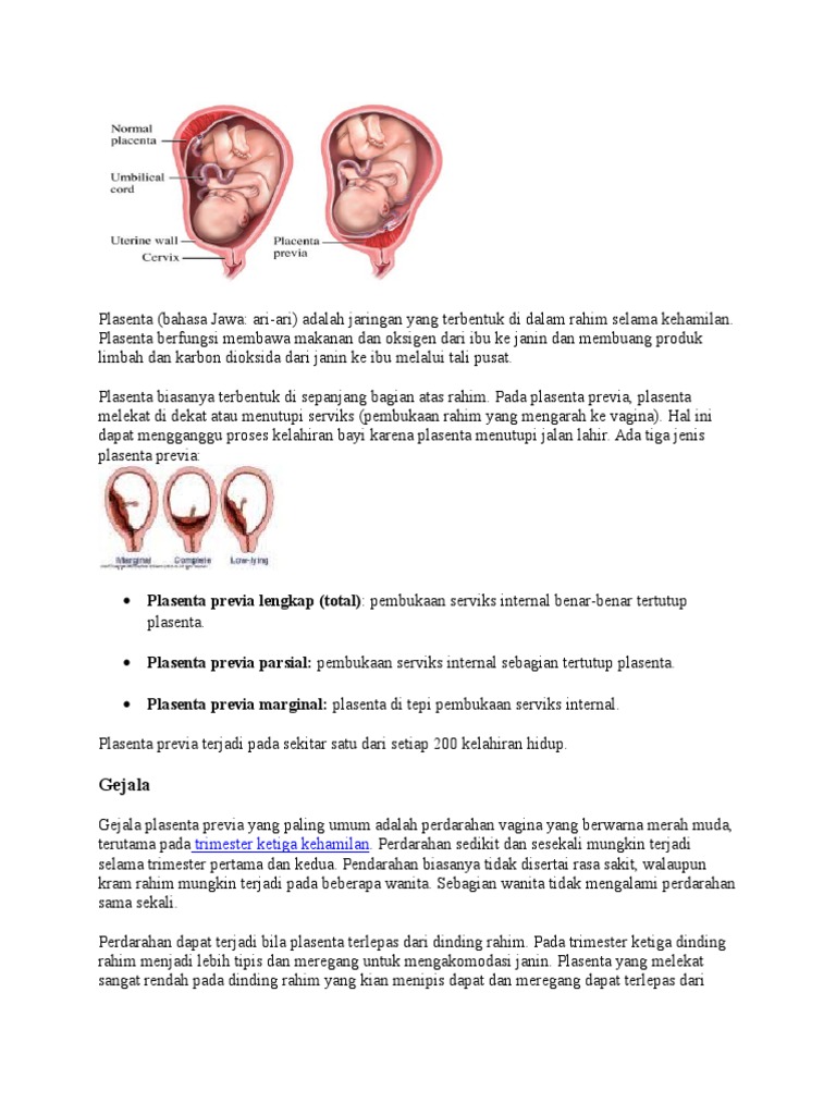 ASUAHAN KEPERAWATAN PADA PASIEN PLASENTA PREVIA | PDF