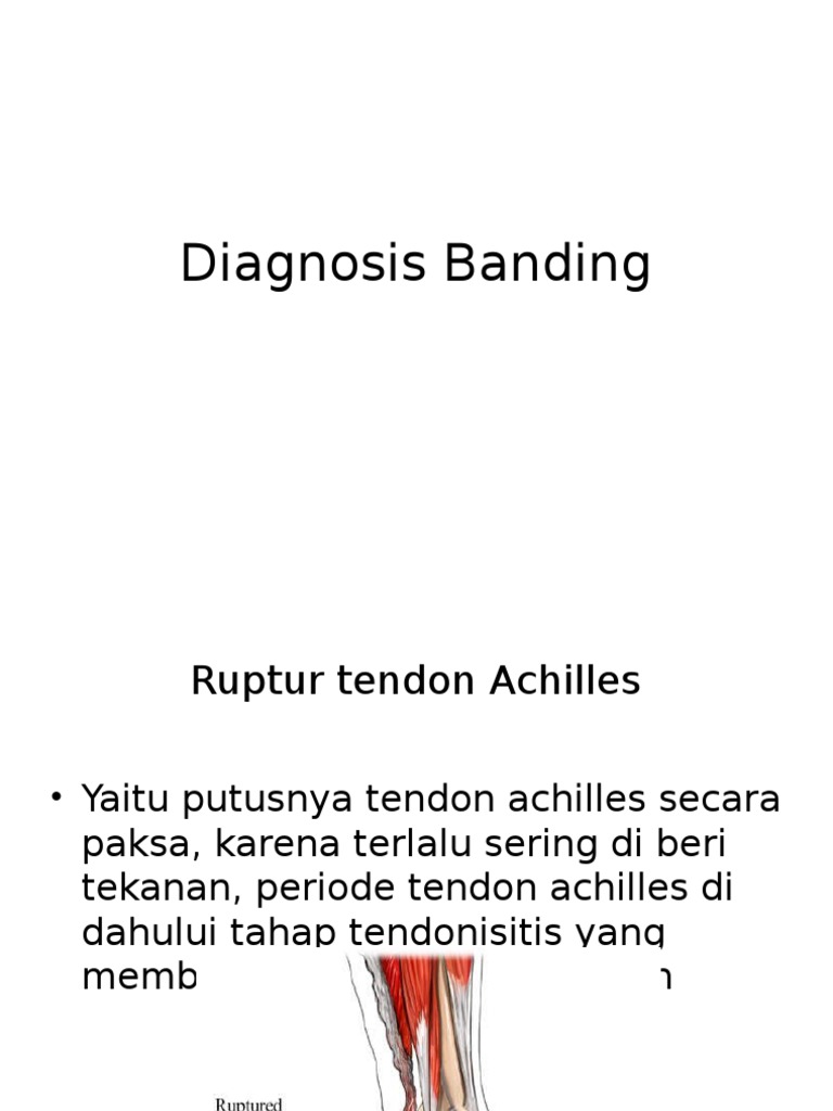 DD Ruptur Tendon Achiles | PDF