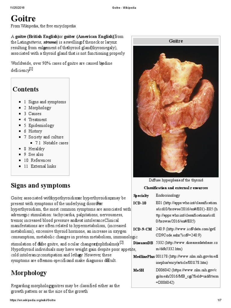 Goitre - Wikipedia.pdf | Endocrine System | Organ (Anatomy)