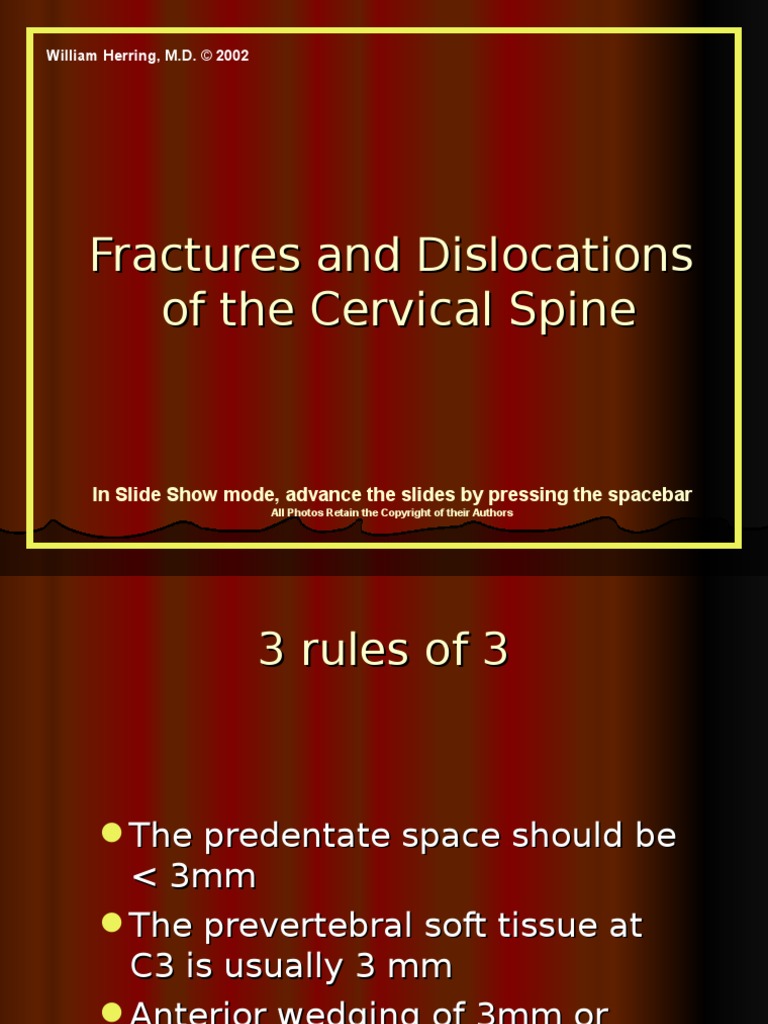 FR and Dislocation of Cervical Spine | PDF | Vertebra | Vertebral Column