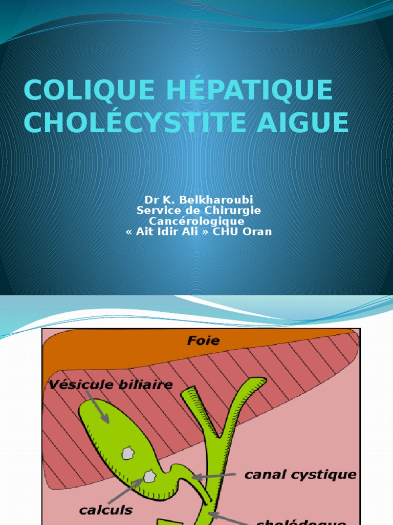Colique Hã©patique Et Cholã©cystite | PDF | Vésicule biliaire | Glande exocrine