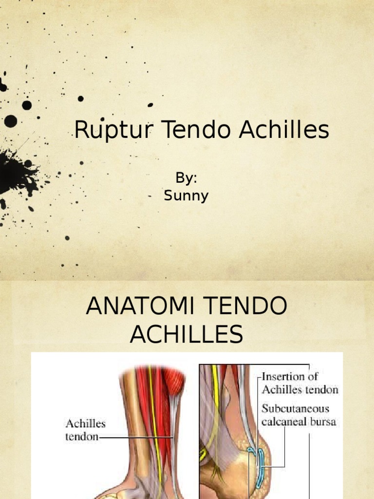 Ruptur Tendon Achilles | PDF