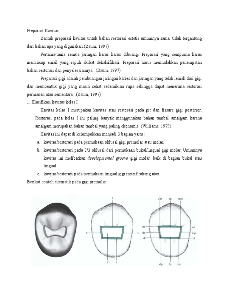 Preparasi Kavitas | PDF