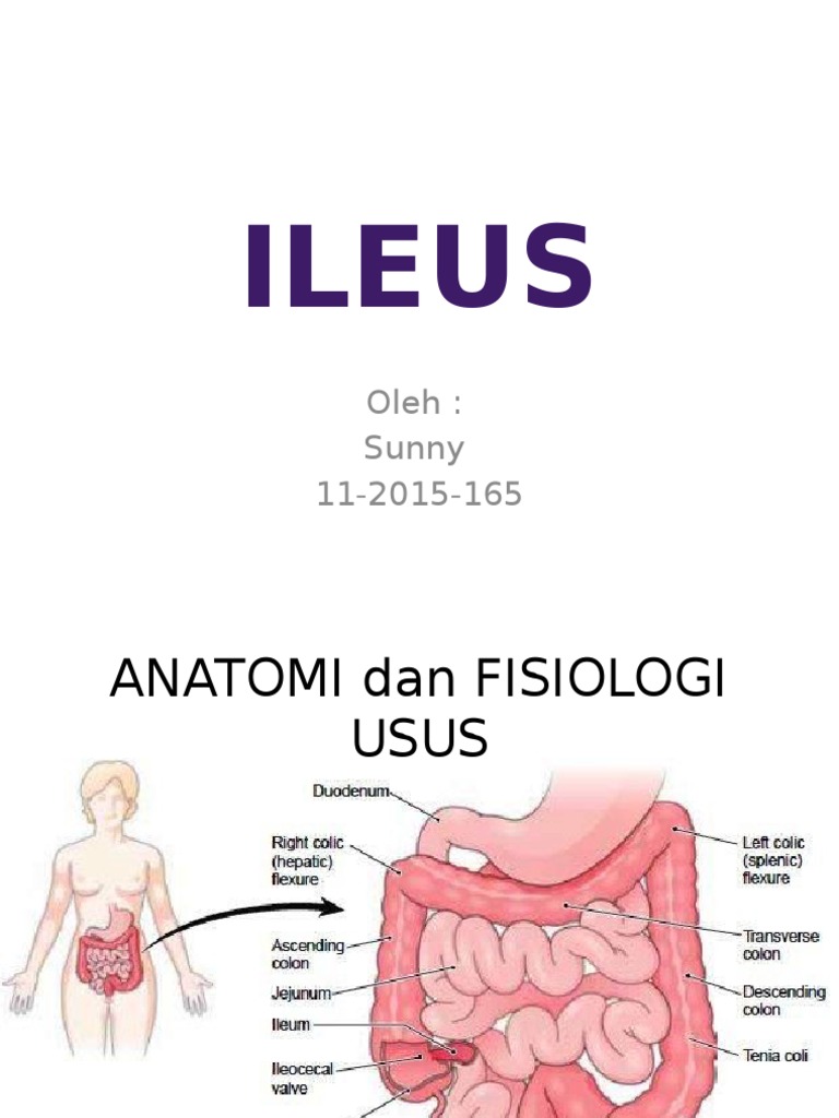 Pemahaman tentang Ileus Obstruktif | PDF