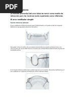 Boton de Nance | PDF | Ortodoncia | Odontología