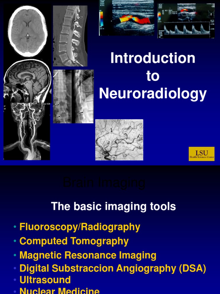 Neuro Radiology | Magnetic Resonance Imaging | Angiography