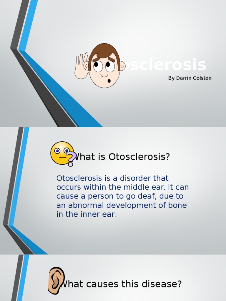 Otosclerosis Presentation Final 1 | PDF