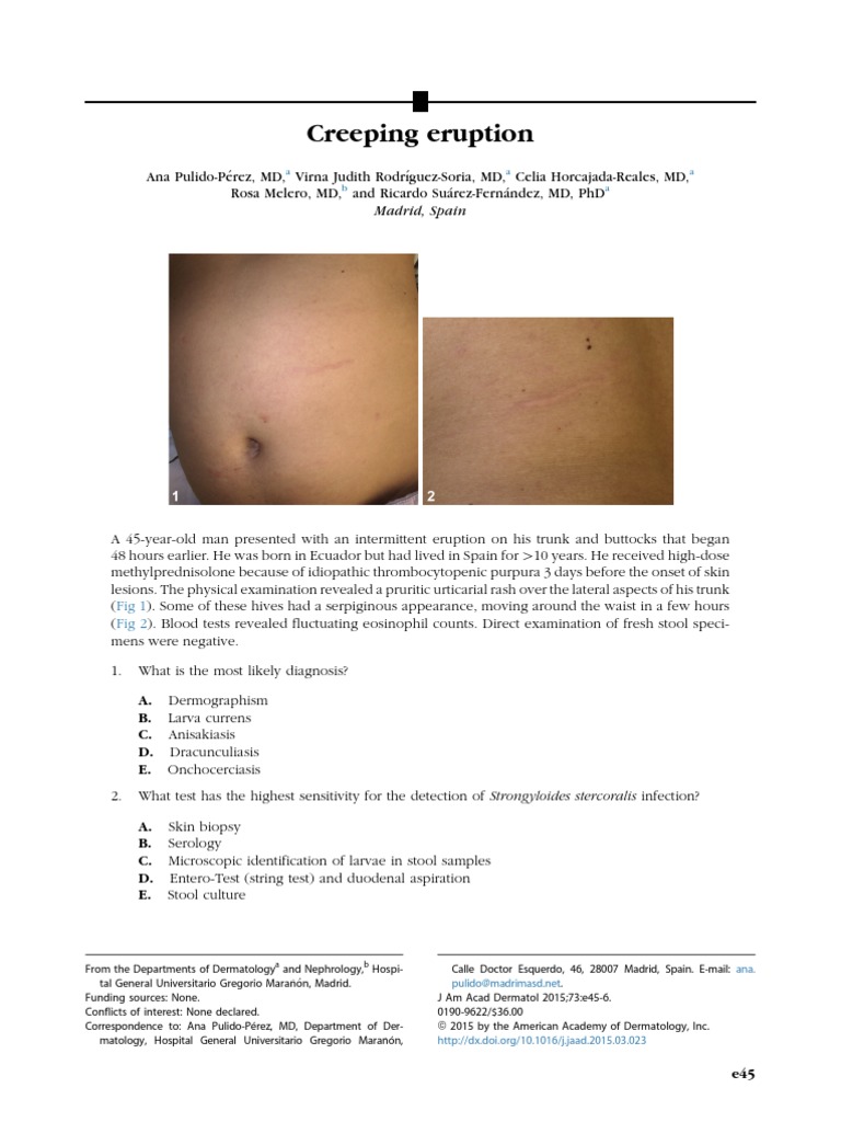 Creeping Eruption: Fig 1 Fig 2 | PDF | Epidemiology | Medicine