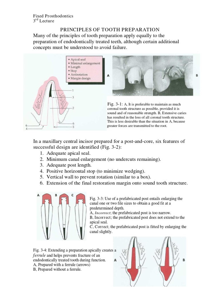Fixed Prosthodontics II - 3rd Lecture - SIUST, College of Dentistry ...