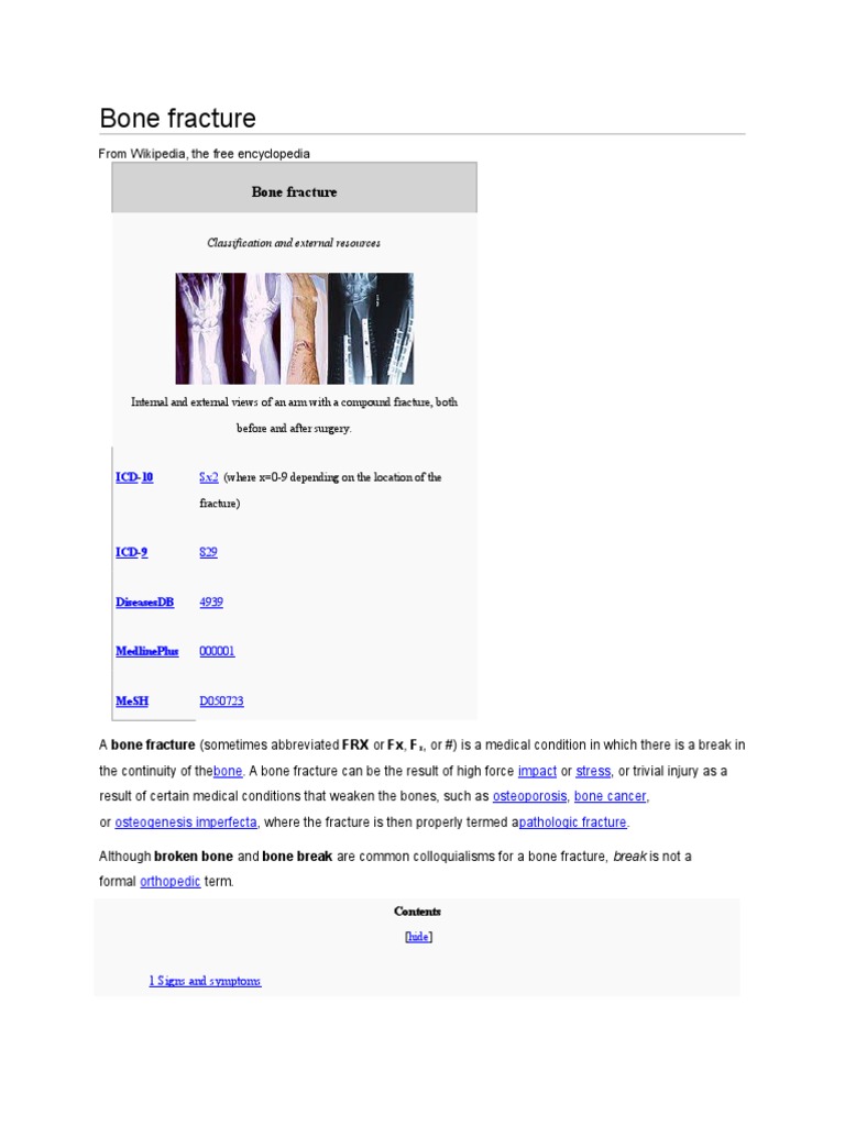 Bone Fracture | PDF | Medical Specialties | Musculoskeletal System