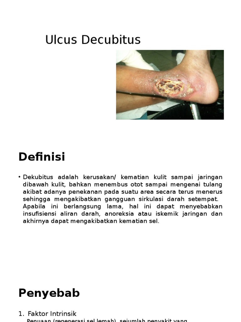 Ulcus Decubitus | PDF