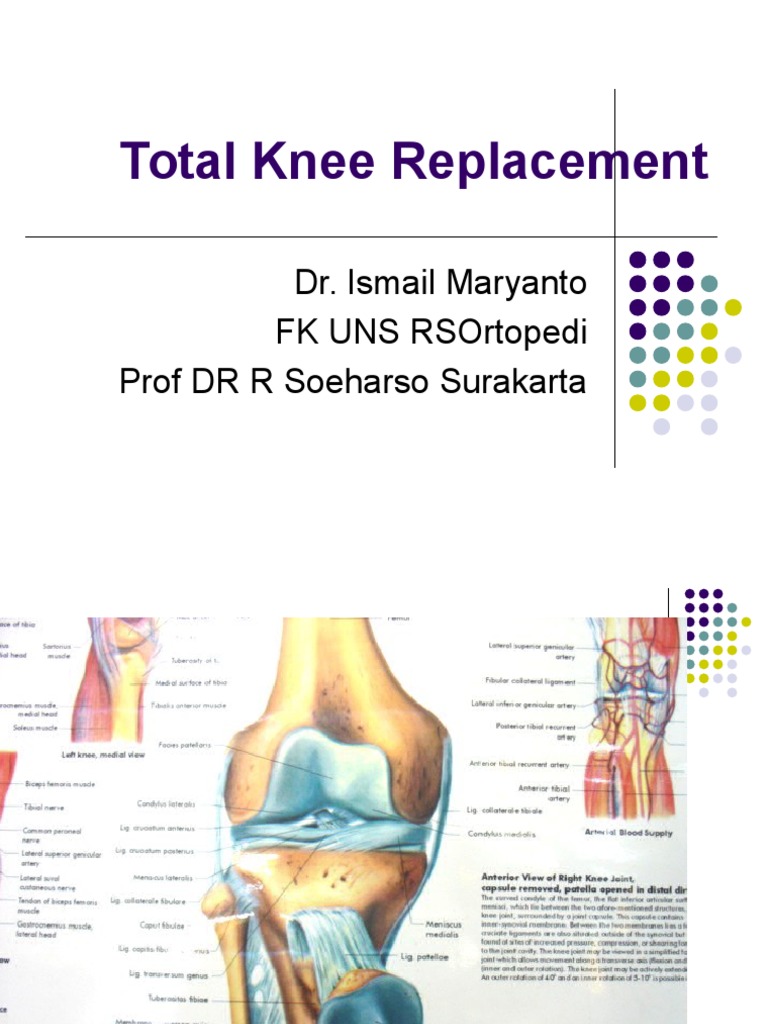 Total Knee Replacement | PDF