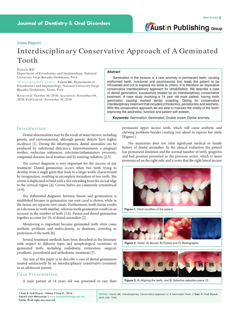 Interdisciplinary Conservative Approach of A Geminated Tooth | PDF ...