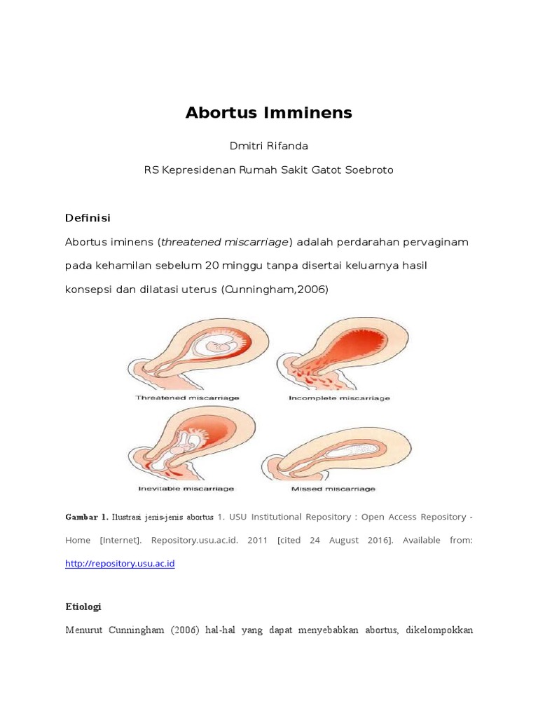 Abortus Imminens