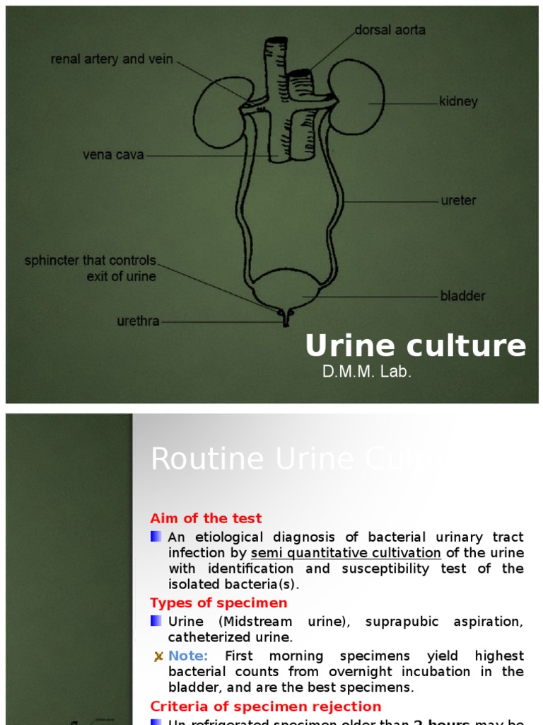 Urine Culture: D.M.M. Lab | PDF | Colony Forming Unit | White Blood Cell