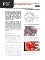 Gans Sensory Organization Performance (SOP) Test | PDF | Vertigo ...