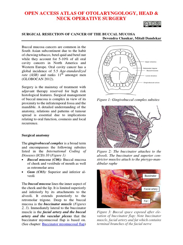Surgical Resection of Cancer of The Buccal Mucosa | PDF | Human Head ...