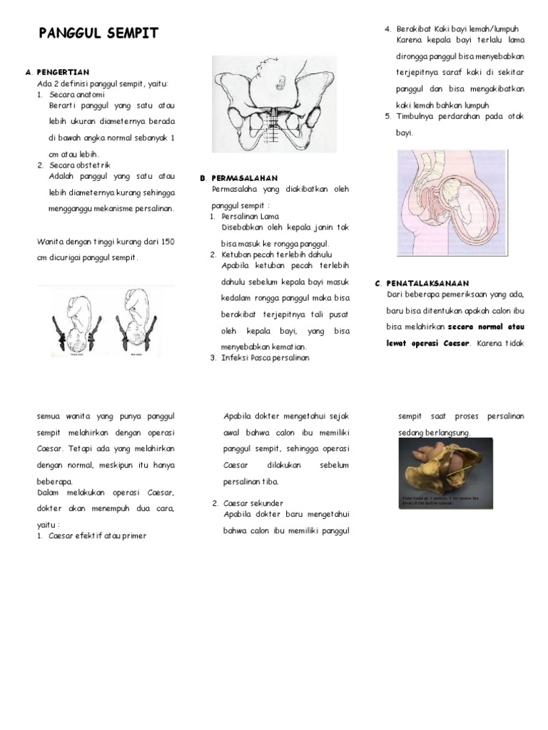 Panggul Sempit | PDF