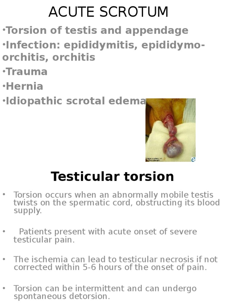 Acutescrotum 141125014842 Conversion Gate01 | PDF | Testicle | Diseases ...