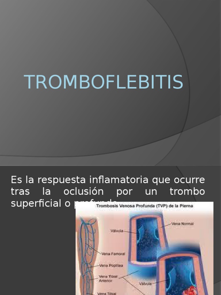 Tromboflebitis | PDF | Trombo | Coagulación